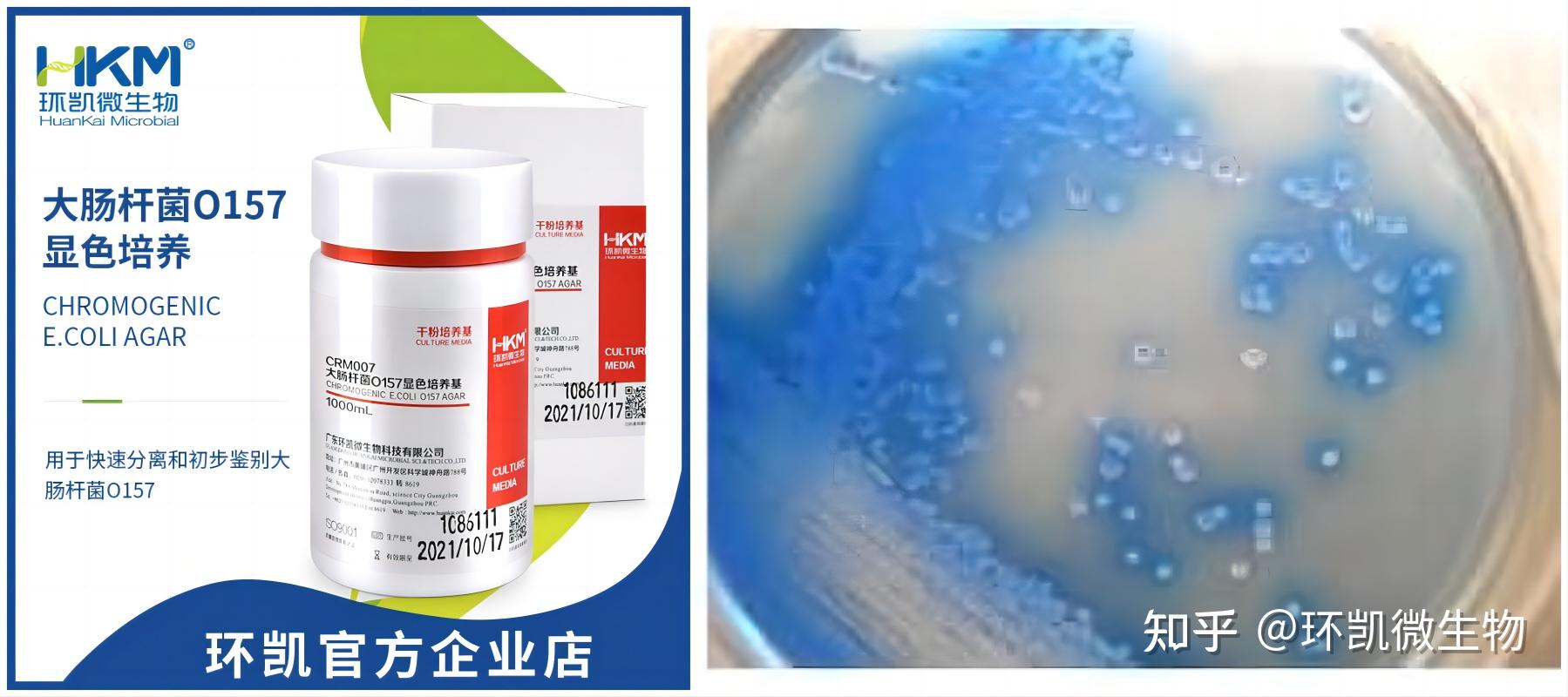 常见微生物菌落形态图及比较 - 知乎