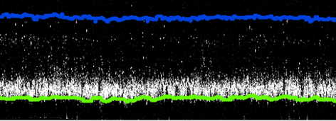 【MFC推荐】C位出圈，IPG LDD激光焊接全过程监测系统 - 知乎