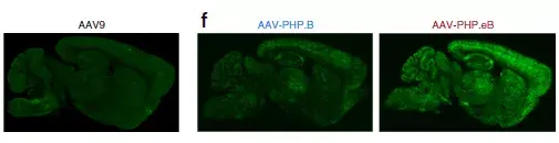 费心整理：神经系统AAV血清型选择指南（值得收藏） - 知乎