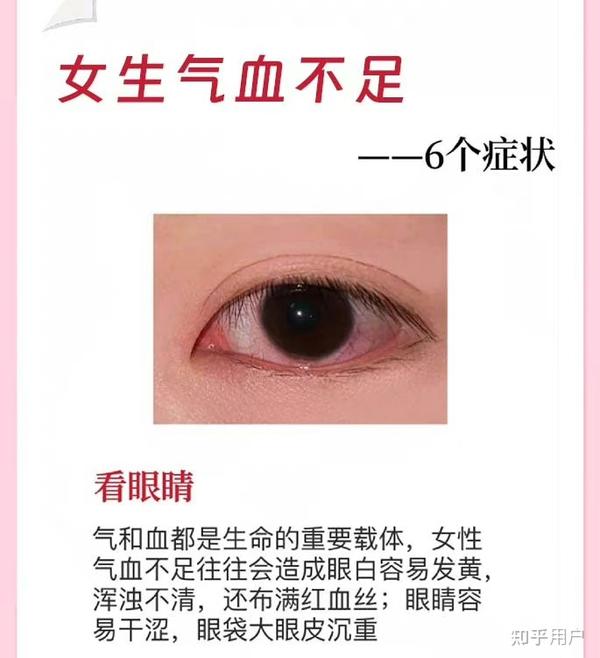 每天对着电脑十个小时的工作和学习，怎么保护眼睛呢？