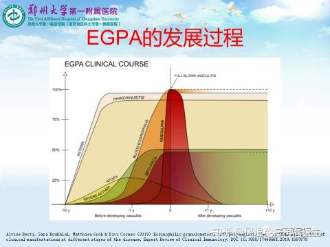 2022年嗜酸性肉芽肿性多血管炎(EGPA)诊治进展及美国风湿病学年会回顾，靶向治疗带来希望 - 知乎