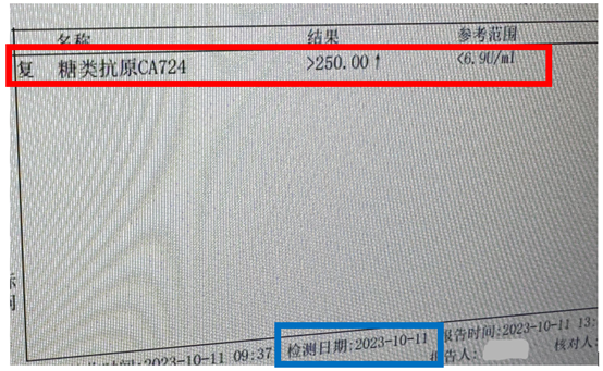 恰当看待血清CA724升高 - 知乎