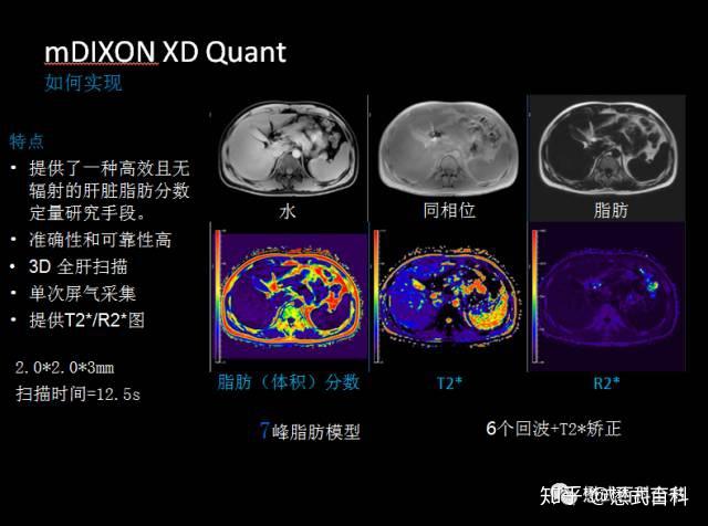 磁共振序列的命名及名称（不同厂家之间的序列名）（三） - 知乎