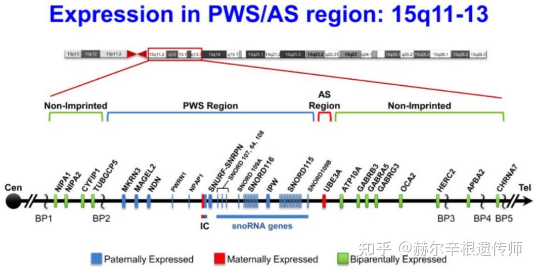 15q11.2q13区域缺失重复综合征（15q11.2缺失综合征、小胖威廉综合征、天使综合征）疾病介绍及应对策略 - 知乎