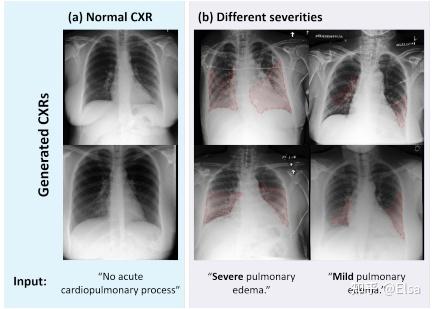 论文解读：LLM-CXR 采用instruction-finetuning提升多模态大模型在医疗影像诊断的效果 - 知乎