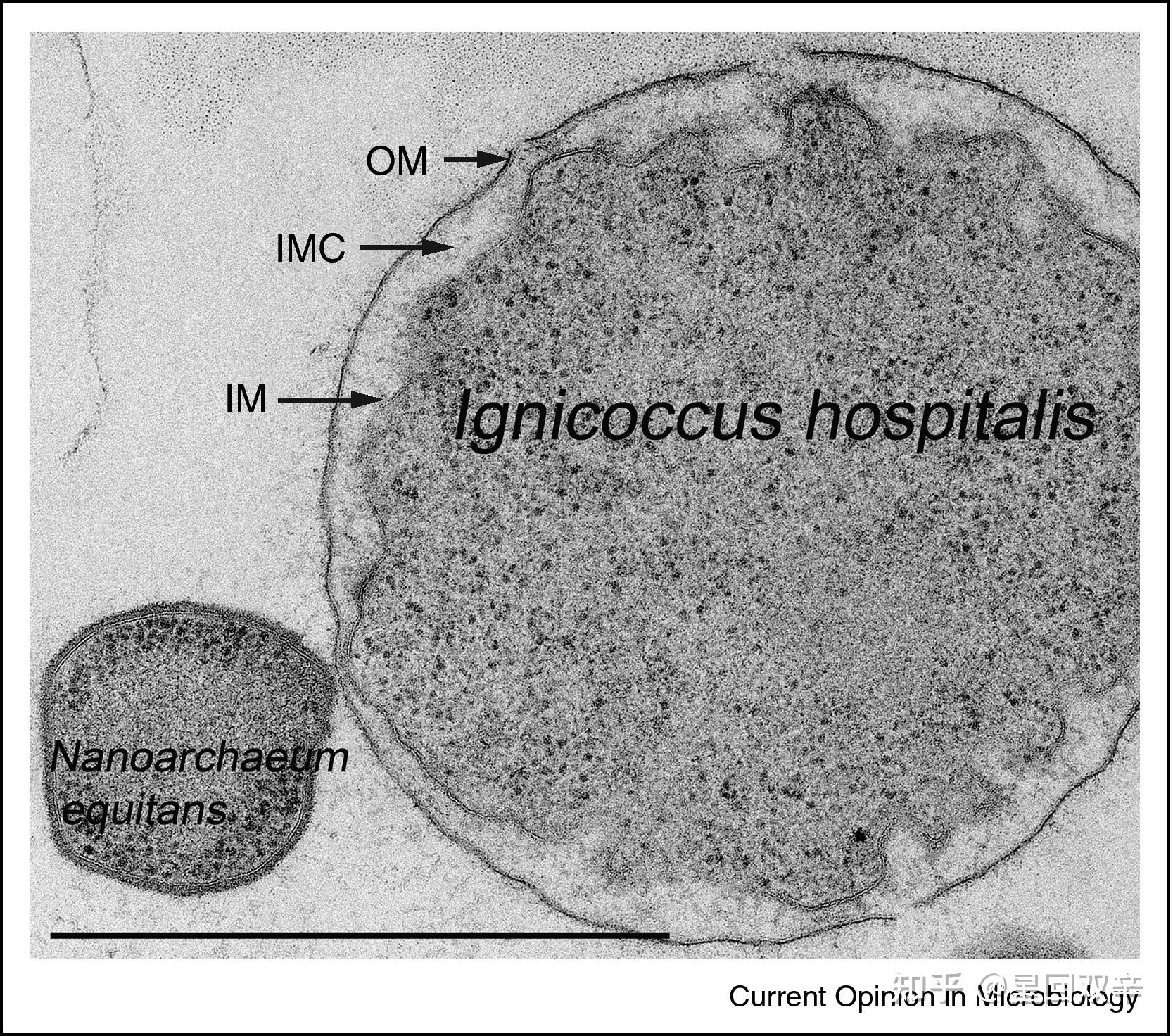 细菌、真菌感染很普遍，为何从未听说过古菌感染？ - 知乎