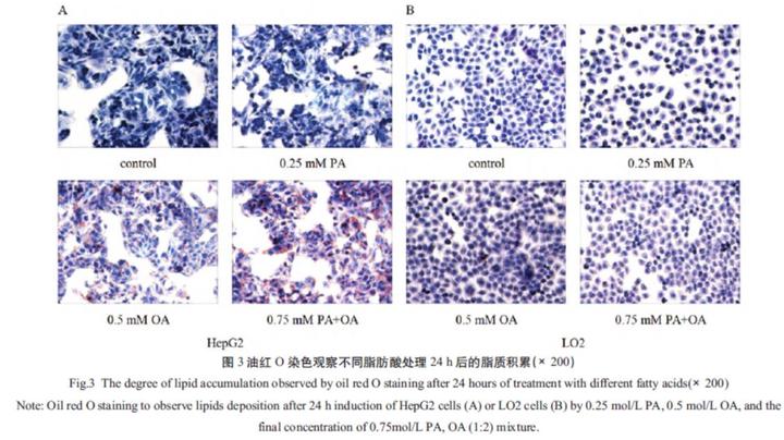 棕榈酸PA、油酸OA诱导肝细胞系（HepG2、LO2细胞）建立代谢相关脂肪性肝病细胞损伤模型（MAFLD） - 知乎