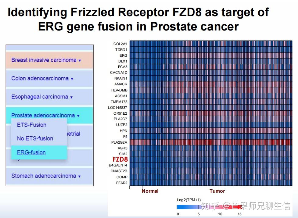 肿瘤免疫 · 实操教程Day10.UALCAN使用教程 - 知乎