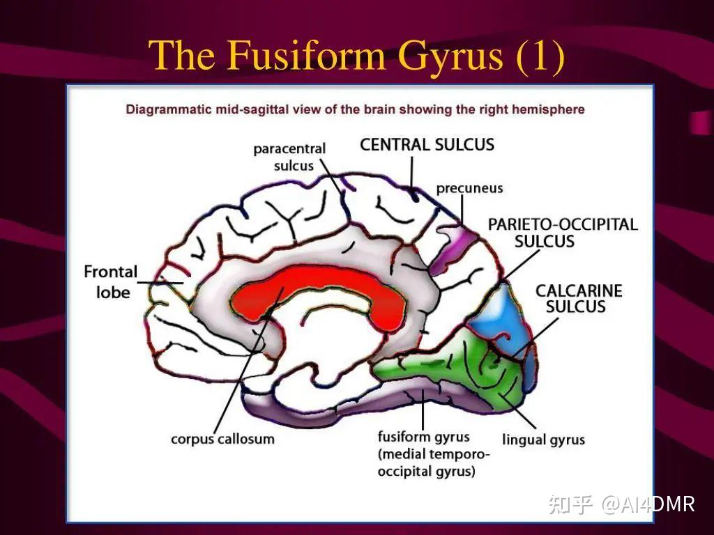 文献分享 | PNAS：先天性失明患者白内障手术后的白质可塑性 - 知乎