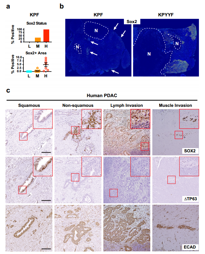 Nature commu|晚期胰腺导管腺癌中自发进化的祖细胞niches逃避Yap癌基因成瘾 - 知乎