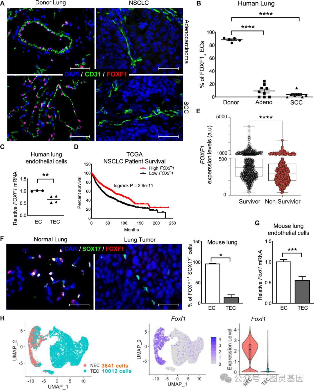 EMBO Mol Med | 发现肺癌转移新靶点：FOXF1 - 知乎