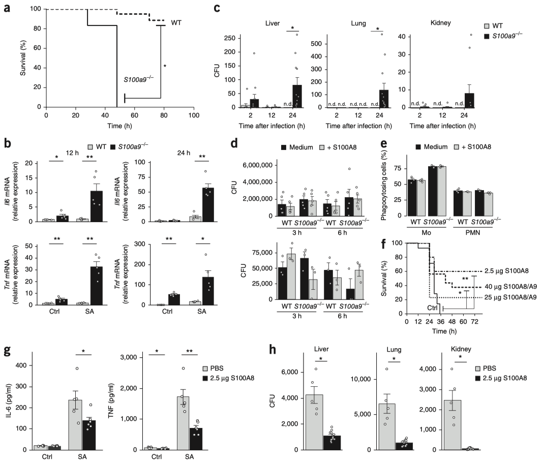 Nature Immunology丨S100-armin 诱导的先天免疫程序可保护新生儿免受脓毒症影响 - 知乎