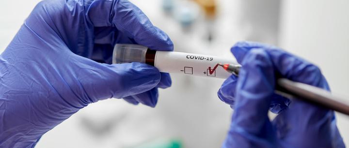 体外诊断行业情况梳理 - 知乎