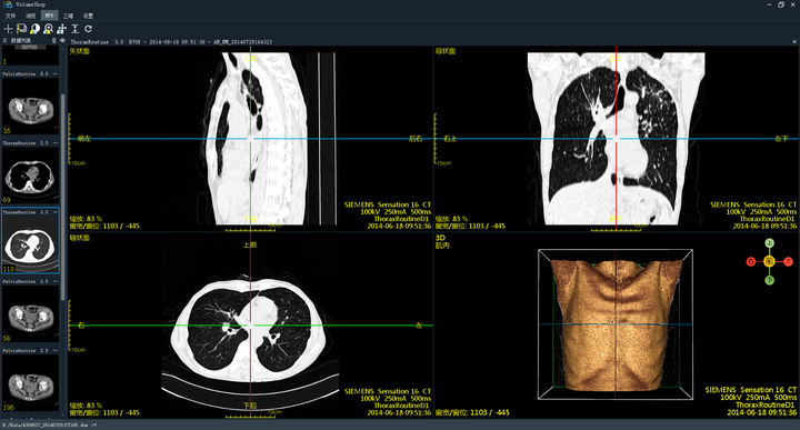医学影像MPR（多平面重建）介绍 - 知乎