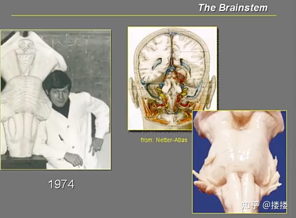 巴特朗菲教授(Helmut Bertalanffy) - 知乎