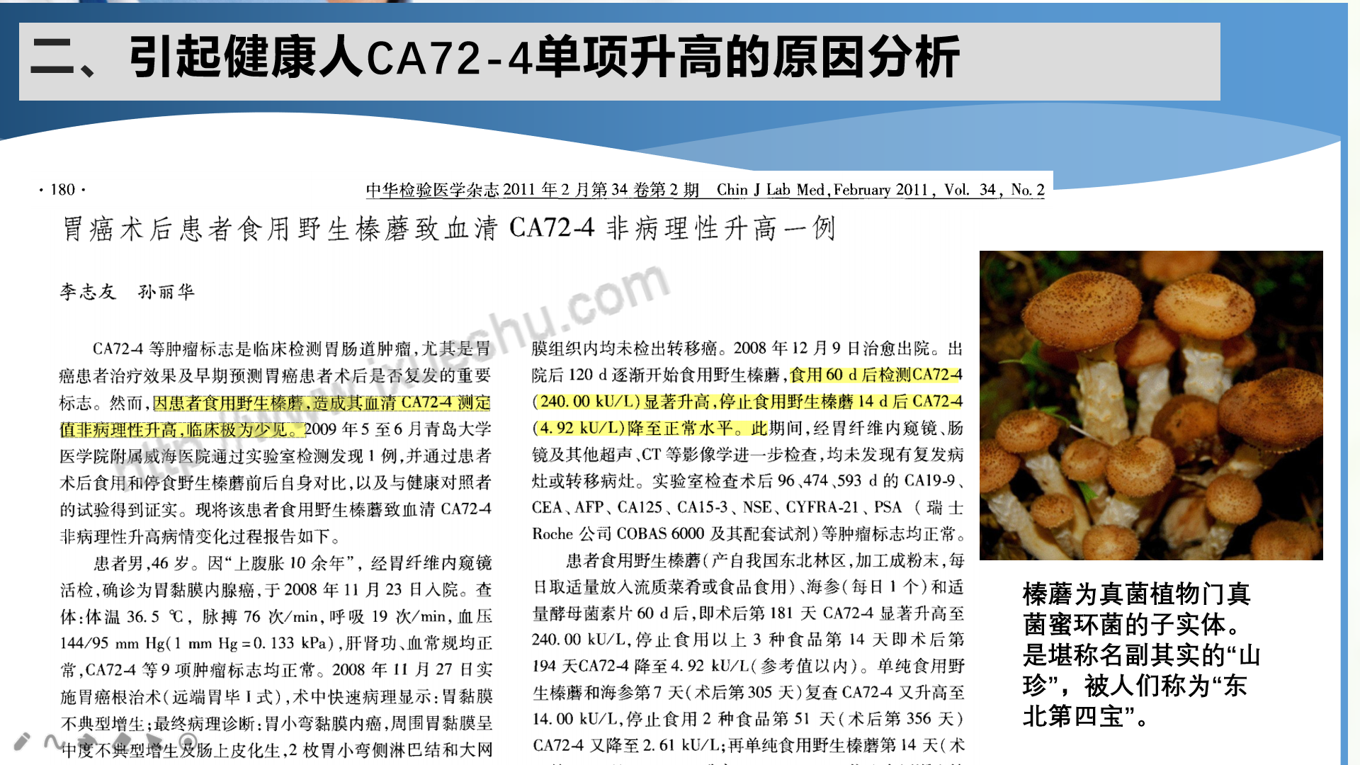 每年的体检中CA724偏高到底要不要紧？ - 知乎