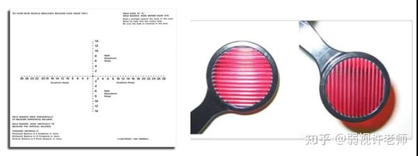 您有一封“检测报告”待读——隐斜检查 - 知乎