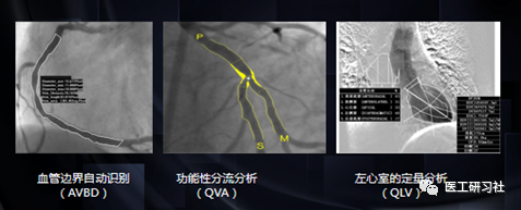 一文盘点全线DSA产品：万东医疗篇 - 知乎