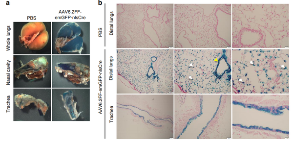 腺相关病毒载体（AAV）在肺脏的研究及应用 - 知乎