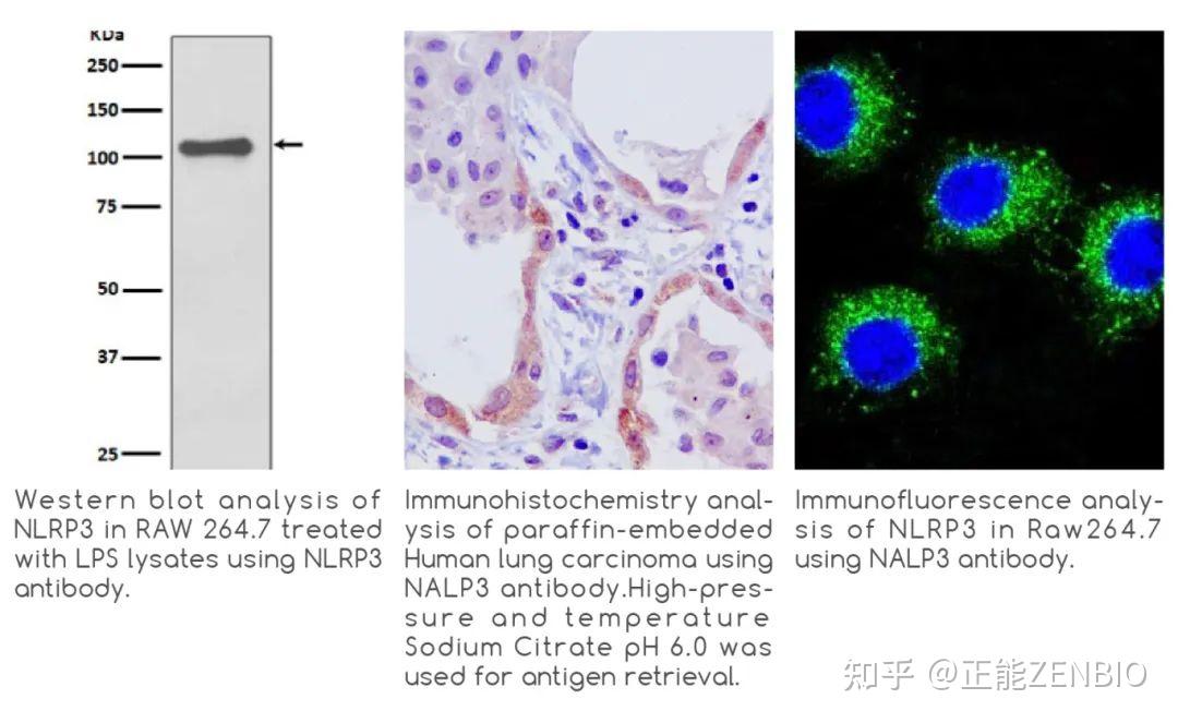 NLRP3蛋白：免疫调节中的关键角色 - 知乎