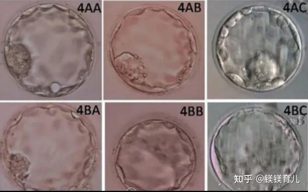 4bc的囊胚有必要 - 知乎
