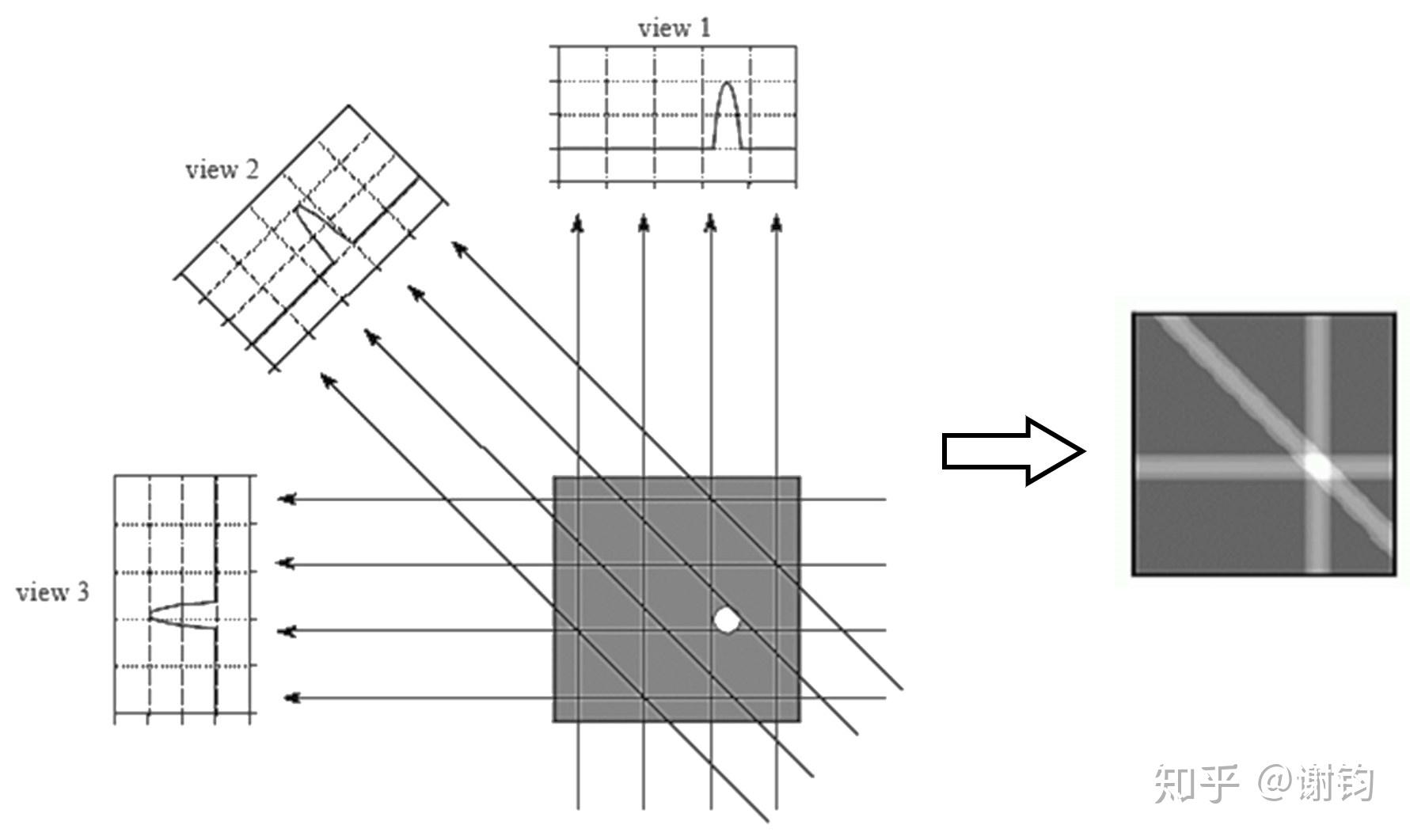 现代医学成像（3）——CT（基本原理与图像重建） - 知乎