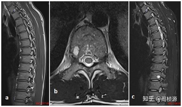 DOI: 10.37532/ijav.2019.12(4).33-34 - 知乎