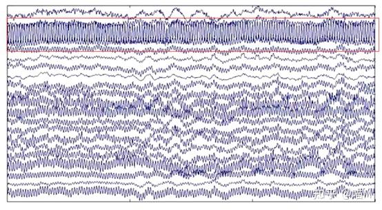 EEGLAB静息态脑电基本处理步骤 - 知乎