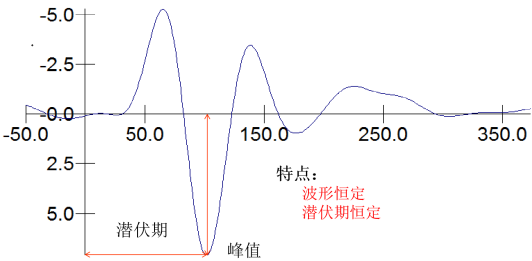 脑电系列第一期：初识脑电，EEG与ERP的关系 - 知乎