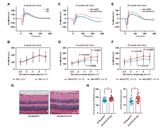 老病新解结晶样视网膜变性（BCD）——基因治疗的光明使者VGR-R01 - 知乎
