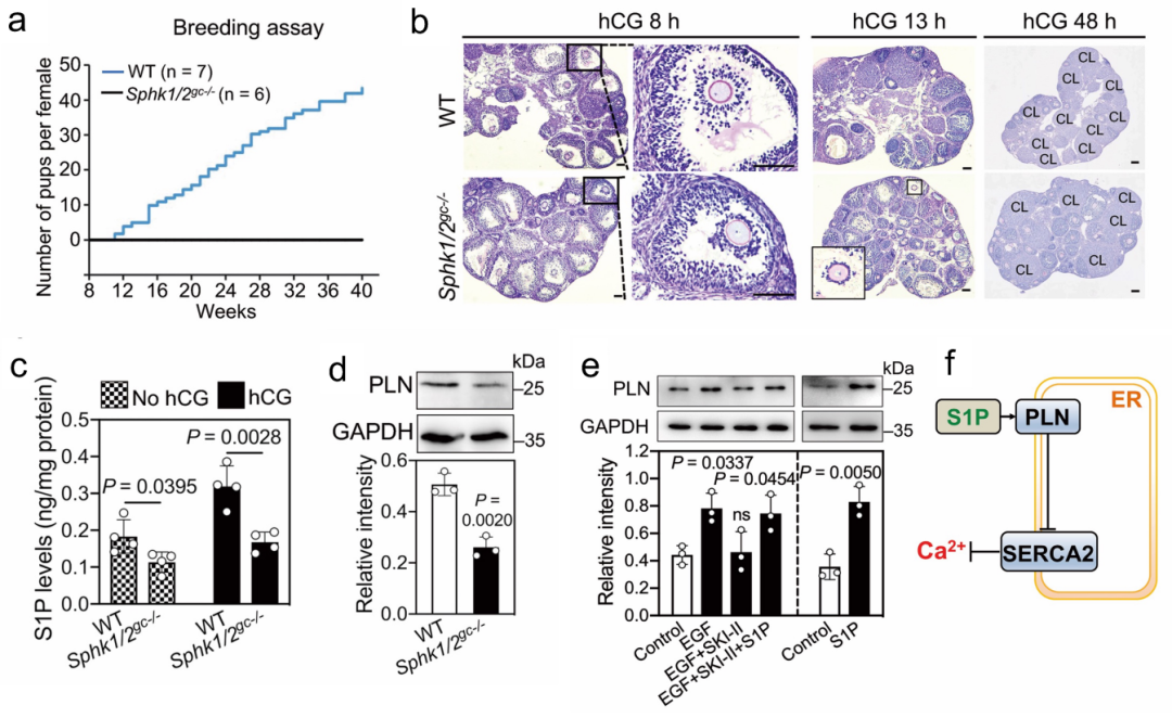 Cell Death Dis︱张美佳/苏友强课题组合作揭示鞘氨醇-1-磷酸（S1P）促进小鼠卵母细胞成熟的分子机制 - 知乎