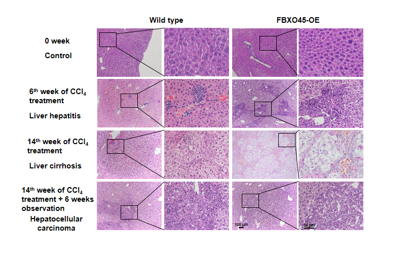 STAR Protocols︱陆军军医大学谢传明课题组发展利用化学药物加速转基因小鼠肝癌进展的实验方案 - 知乎