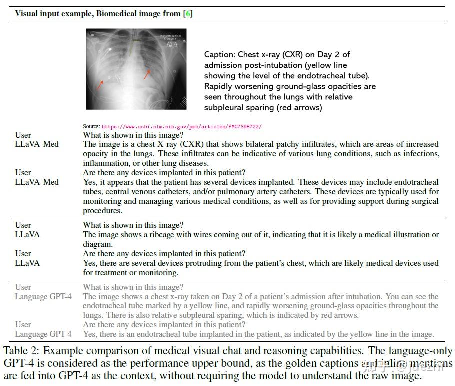 论文笔记1：LLaVA-Med: Training a Large Language-and-Vision Assistant for ...