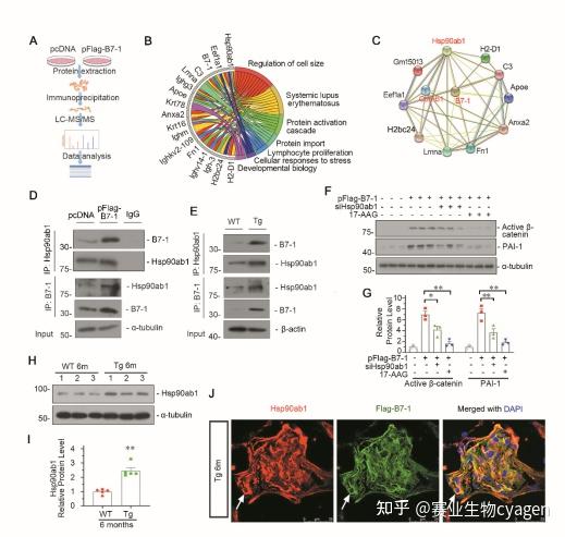 南方医院发现足细胞损伤的重要机制，有望改善靶向B7-1的肾病疗法 - 知乎