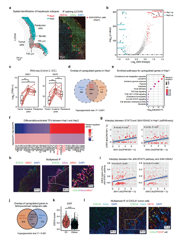 Cell Res | Stereo-seq揭示人类肝癌浸润区促进肝细胞-肿瘤细胞串扰、局部免疫抑制和肿瘤进展 - 知乎
