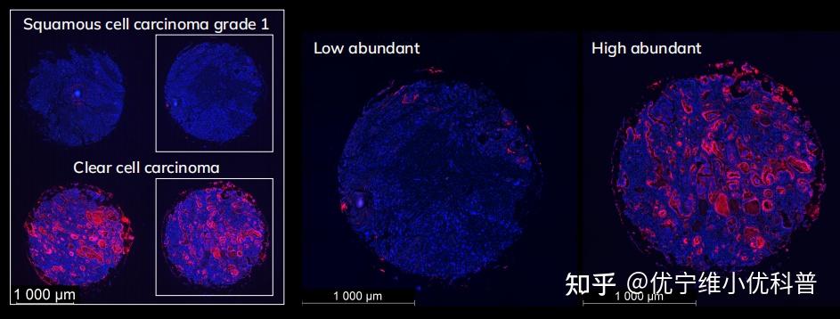小优进修班∣Naveni® PLA产品效果展示 - 知乎