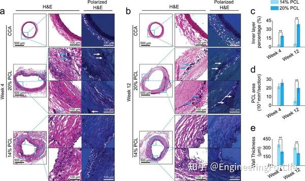 Small： PGS-PCL复合人工血管用于颈总动脉移植 - 知乎