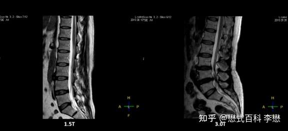 MRI场强对成像及图像质量的影响 - 知乎
