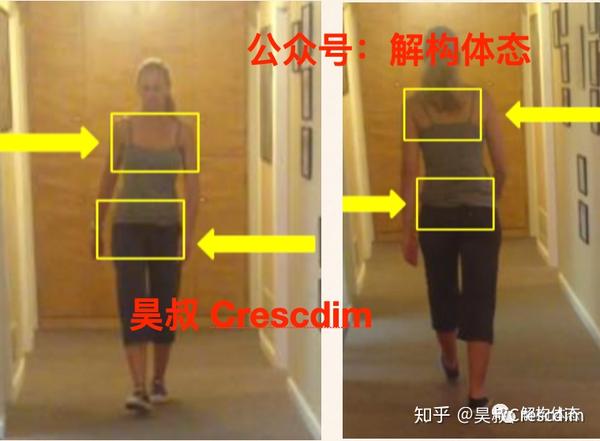 姿势恢复技术（PRI Method）在骶髂关节康复中的应用（上篇） - 知乎