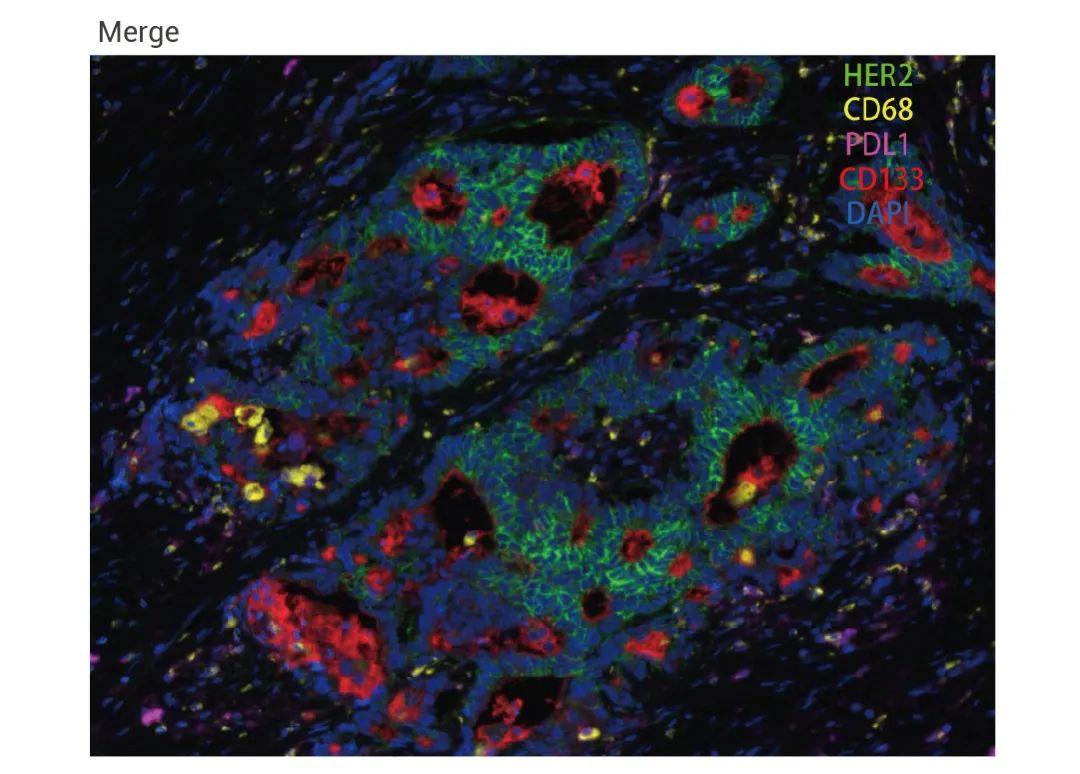 干货分享 | 多重荧光免疫组化技术 (mIHC) - 知乎