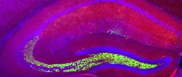 Science | 空间翻译组学测序技术RIBOmap，以单细胞和分子分辨率揭示脑组织翻译调控机制 - 知乎