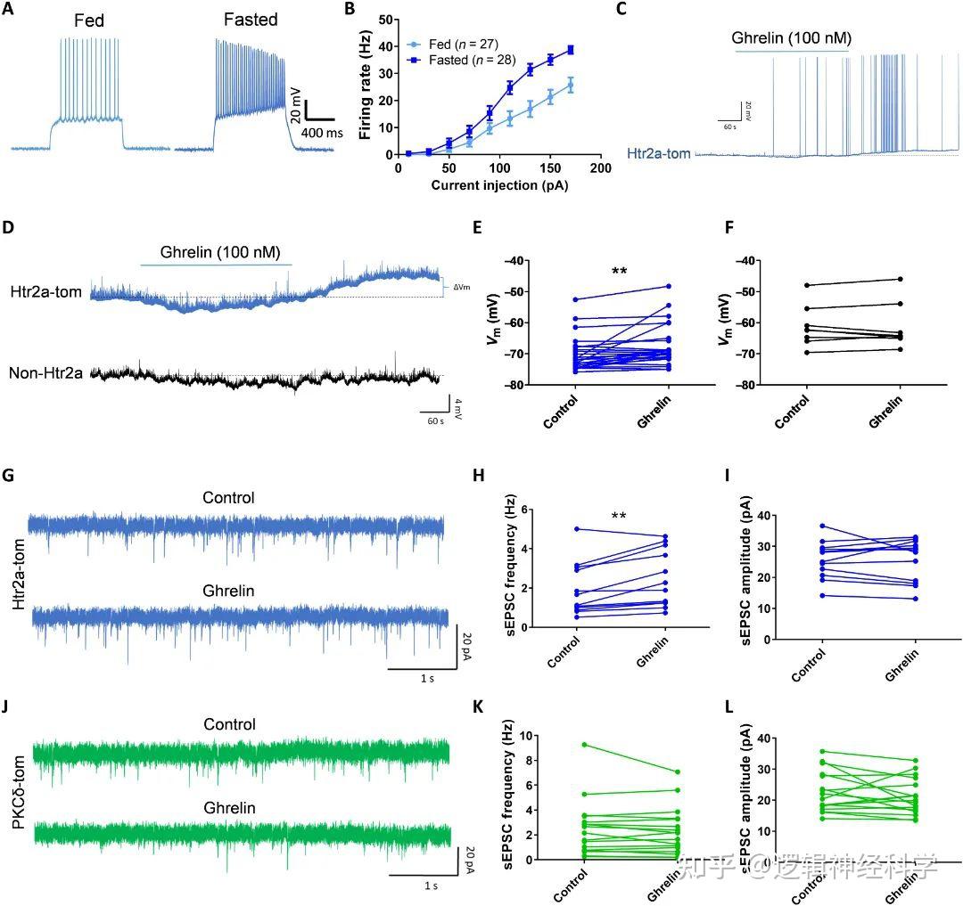 Sci Adv︱德国马克斯·普朗克生物智能研究所团队揭示杏仁核通过胃饥饿素调控进食的新机制 - 知乎