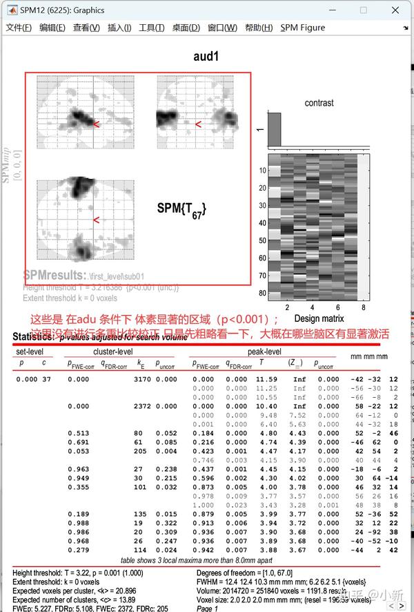 5-SPM-fmri任务态数据 一阶分析(单个被试） - 知乎