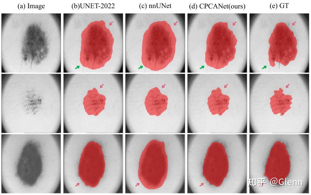 [论文阅读] MedSeg | CPCA：解决通道权重分配一致化的新型注意力机制 - 知乎