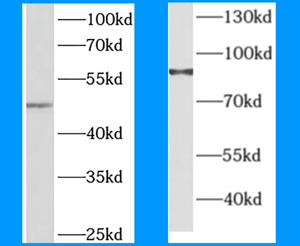 【抗体WB实验】如何做出漂亮的WB条带图 - 知乎