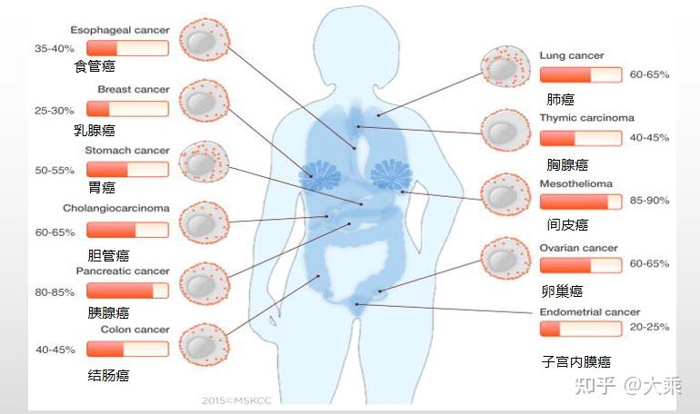 靶向间皮素（MSLN)靶点的CAR-T细胞治疗 - 知乎