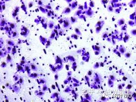 Transwell侵袭实验——入门篇 - 知乎