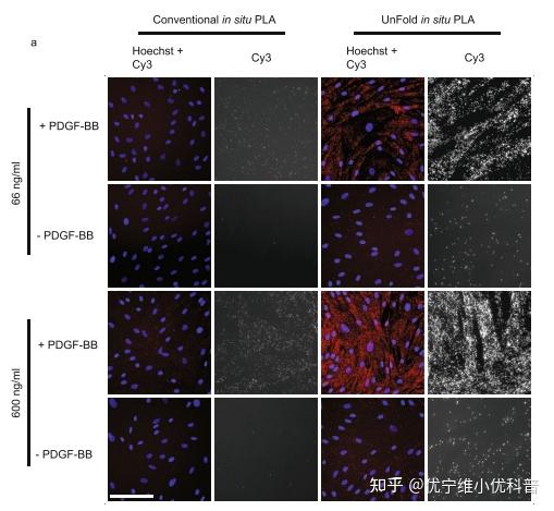 小优读文献∣Naveni® PLA技术&现有文献部分解析 - 知乎