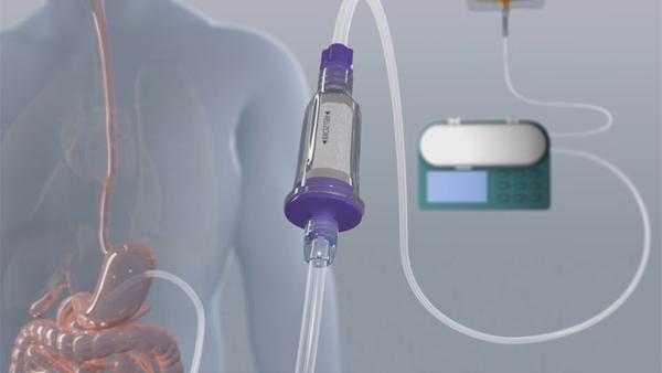 RELiZORB（固定化脂肪酶）获准用于患有脂肪吸收不良的2至5岁以下患者 - 知乎