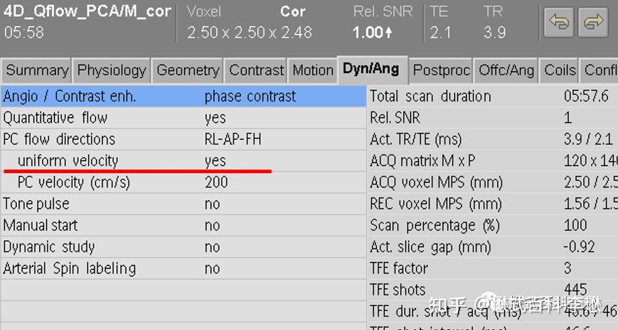 4D-Flow扫描数据采集：序列及参数 - 知乎